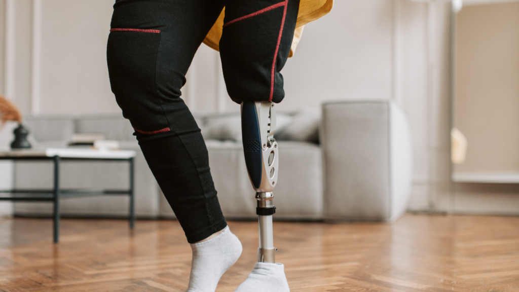 Phantom Limb Pain: Causes and Treatments - Progressive Pain Management ...