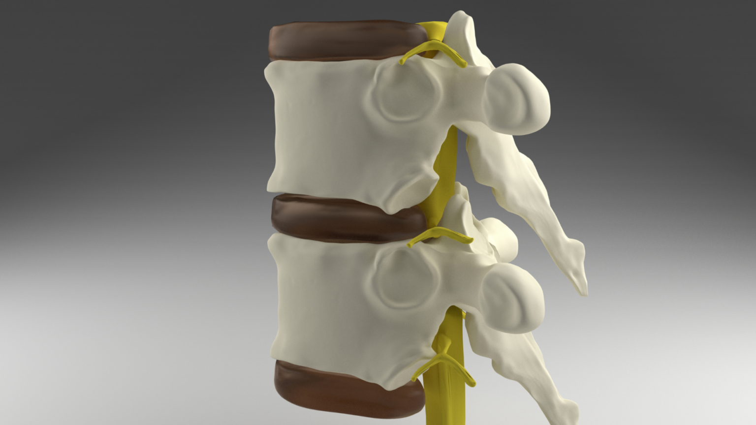 The Facet Joint Injection Procedure - Progressive Pain Management - NJ ...