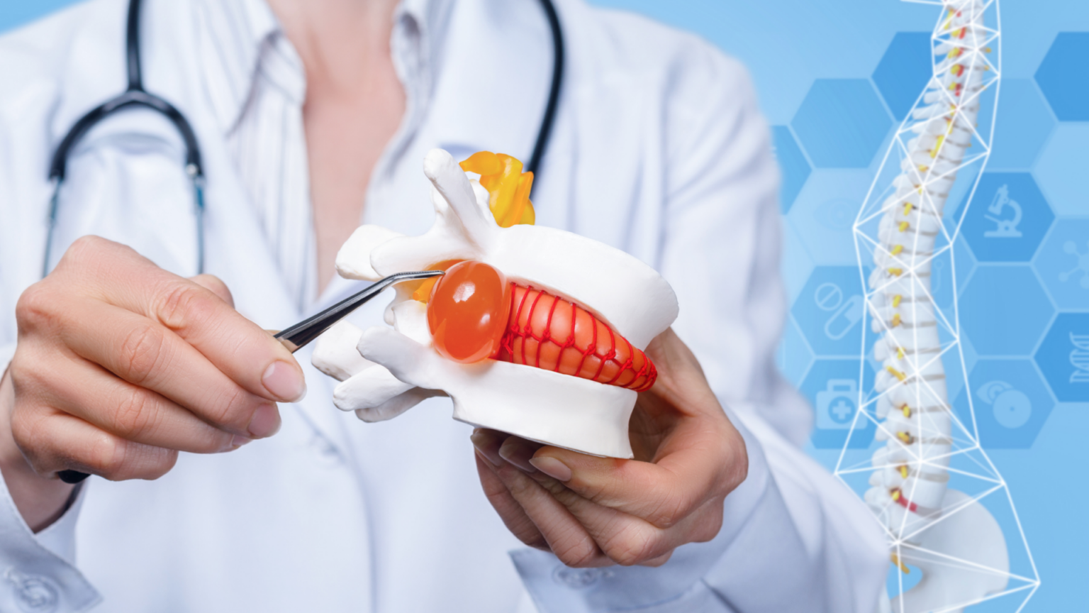 What’s the Difference Between Herniated and Bulging Discs - Progressive ...